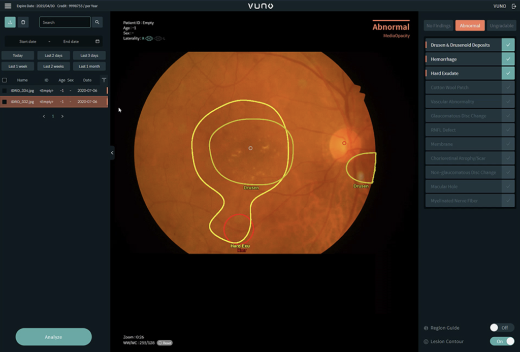 VUNO Med – Fundus AI – Giavu Medical