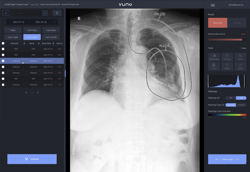 VUNO Med – Chest X-ray – Giavu Medical